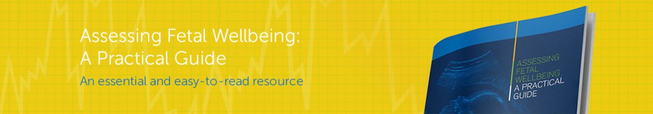 Information for Participants - FSEP